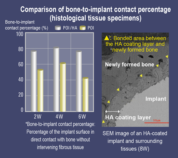 Dental Implants FINESIA® | KYOCERA Medical