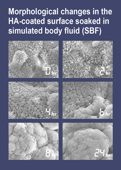 Dental Implants FINESIA® | KYOCERA Medical